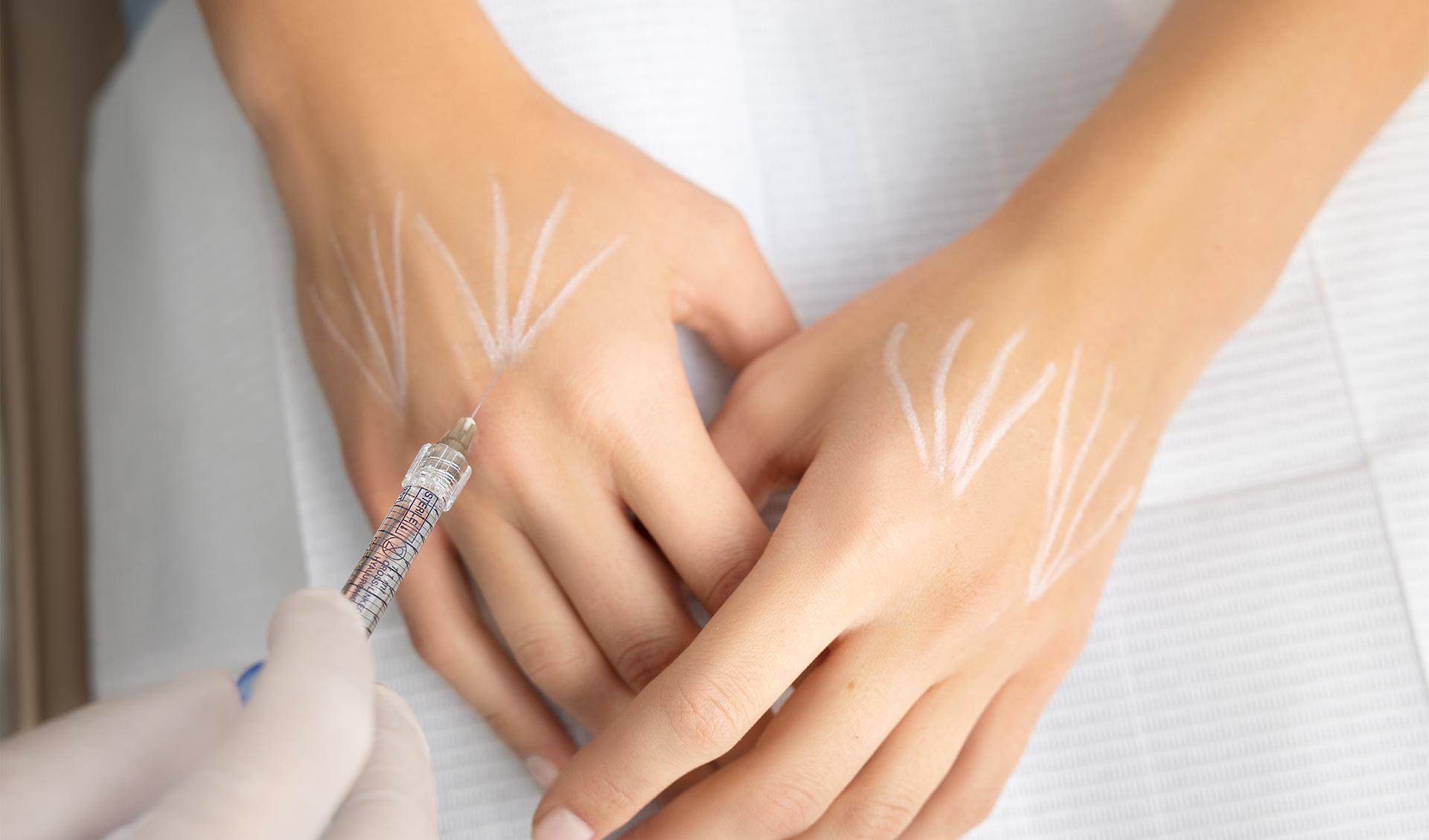 Dermal Fillers – Aesthetic clinic in Dubai | Semi permanent makeup ...